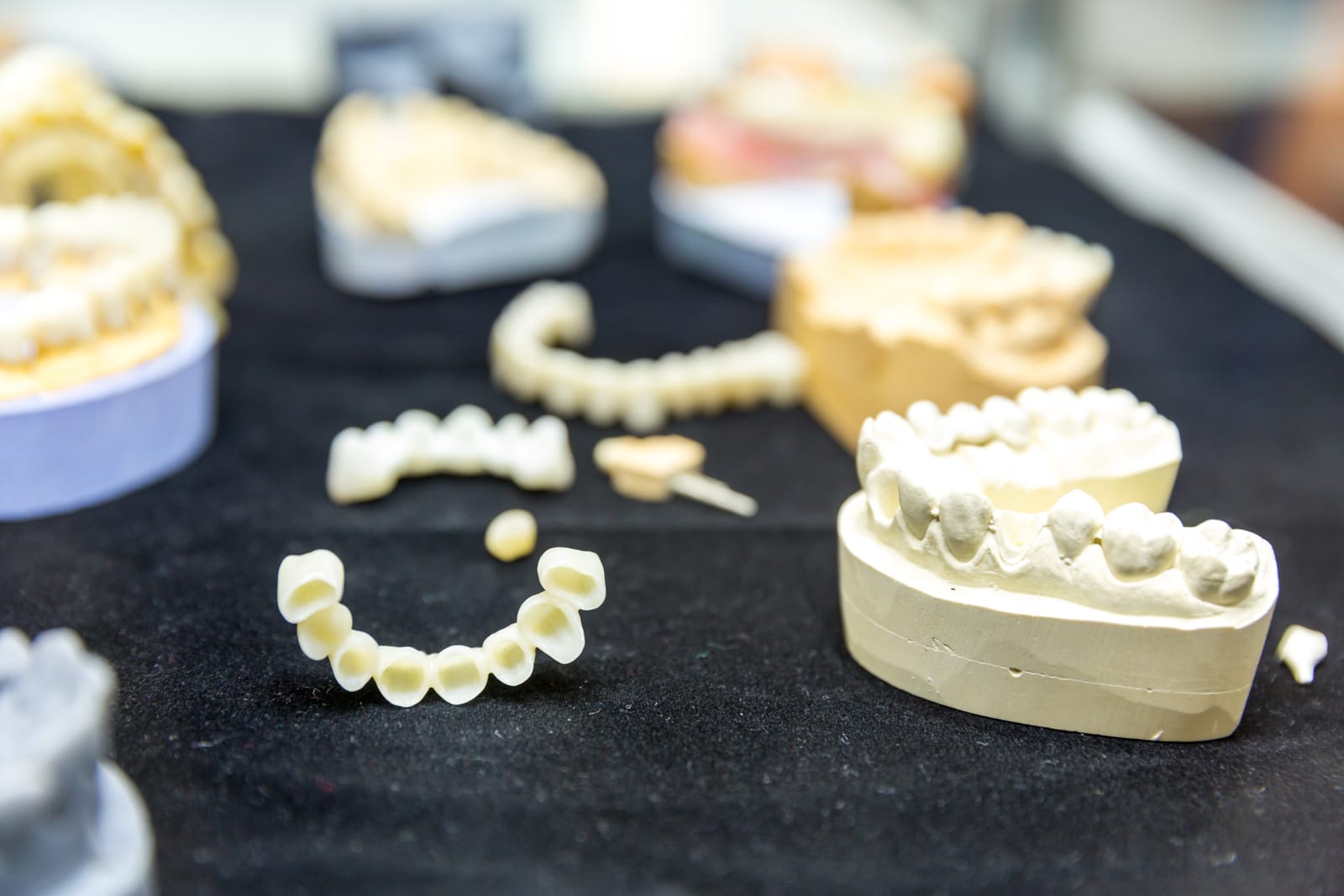 Fall Dental Implants in St. George | Utah Dental Center